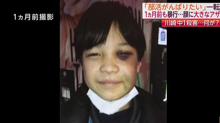 Sadis! Pelajar SMP Di Jepang Ini Tewas Digorok Teman-temannya, Mayat ...