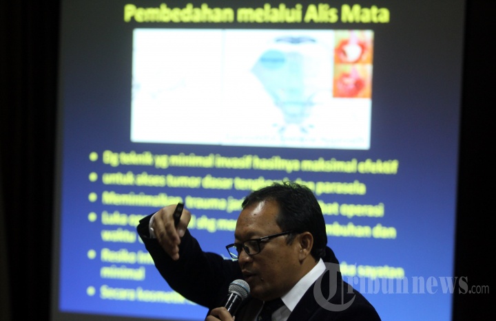 Bedah Tumor Otak Lewat Alis Mata, Foto 2 #1721780 - TribunNews.com