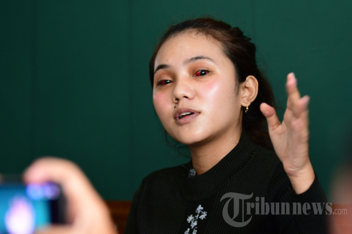 Jadi Korban Tragedi Kanjuruhan, Hingga Kini Mata Naswa Masih Terlihat ...