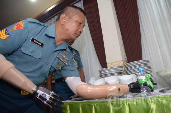 Tangan Bionic Produksi Undip dan RSAL Dr Ramelan, Foto 3 #1728703 ...