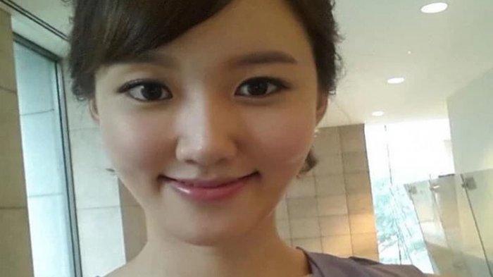 Choi Young Ah - TribunnewsWiki.com