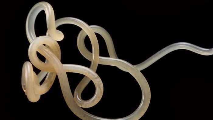 Cacingan - TribunnewsWiki.com