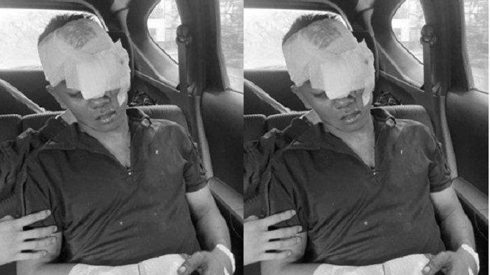 Kronologis Aparat TNI Prada Defliadi Dibacok Dolly Manurung Geng Motor ...