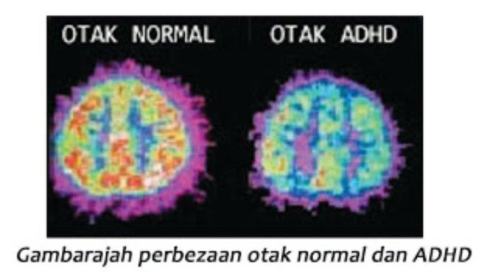 Amfetamin - TribunnewsWiki.com