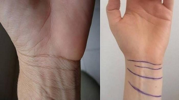 Jumlah Garis di Pergelangan Tangan Bisa Tunjukkan Masa Depan, Coba ...