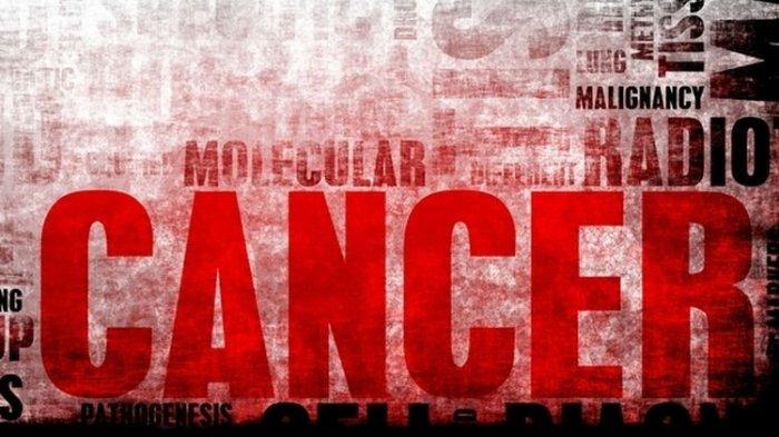 Kanker Esofagus - TribunnewsWiki.com