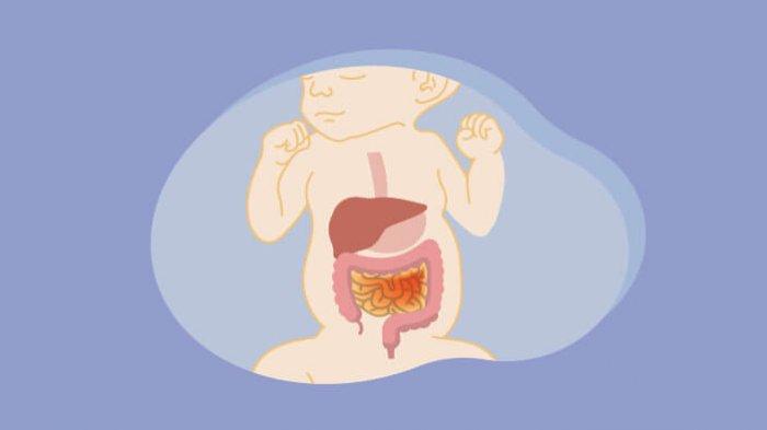 Necrotizing Enterocolitis - TribunnewsWiki.com
