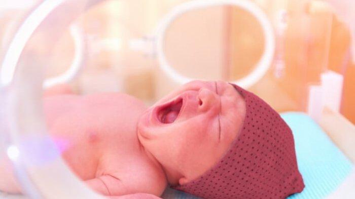 Sindrom Edward - TribunnewsWiki.com