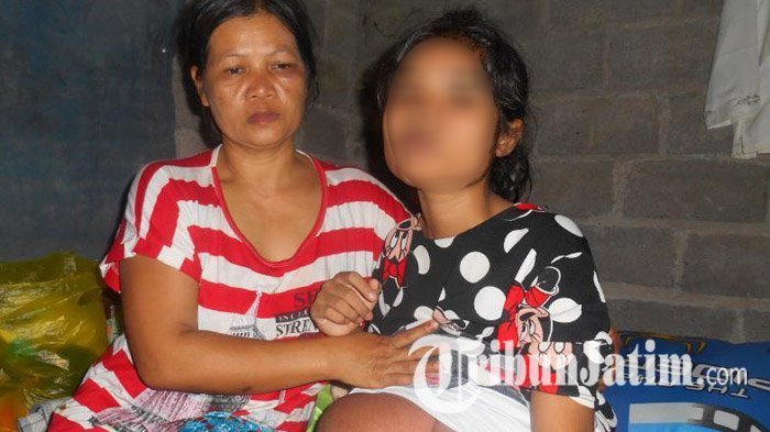 Payudara Gadis 15 Tahun Ini Terus Membesar Berawal dari Terbentur ...