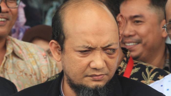 Mata Kiri Novel Baswedan Buta Total Sejak Awal Februari 2020, Kini ...