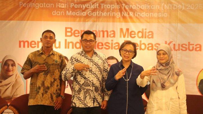 Kasus Penyakit Kusta di Indonesia Ditargetkan Turun Dalam 5 Tahun ...