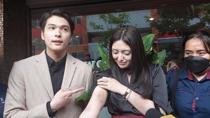 Dihajar Pria Gemulai saat Dugem, Aspri Hotman Paris Intan Nallendra: Dia Lecehkan Pacar Saya ...