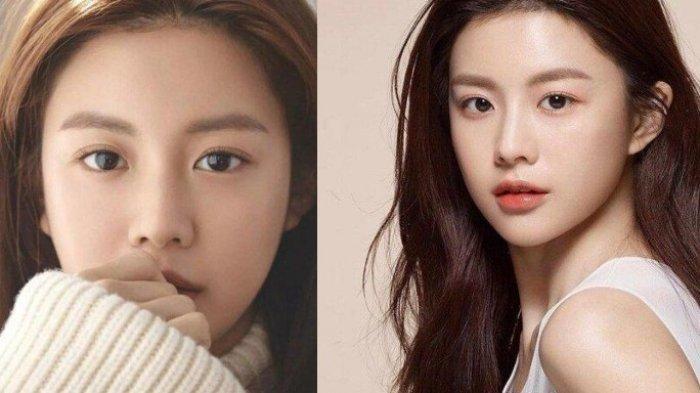 Go Yoon Jung Dianggap Memiliki Wajah Proporsional, Apakah Hasil Operasi ...