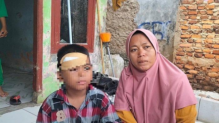 Diserang Monyet Liar di Cipayung Depok, Abiyu Alami Luka Robek hingga 10 Jahitan di Bagian Dahi ...