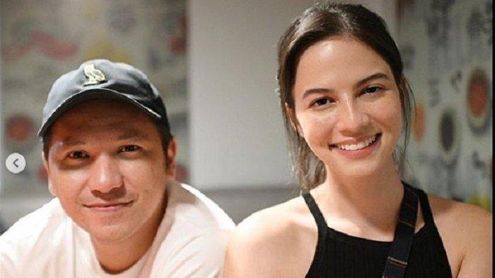Tiga Fakta tentang Juria Hartmans, Model yang Belakangan Dikabarkan Dekat dengan Gading Marten ...