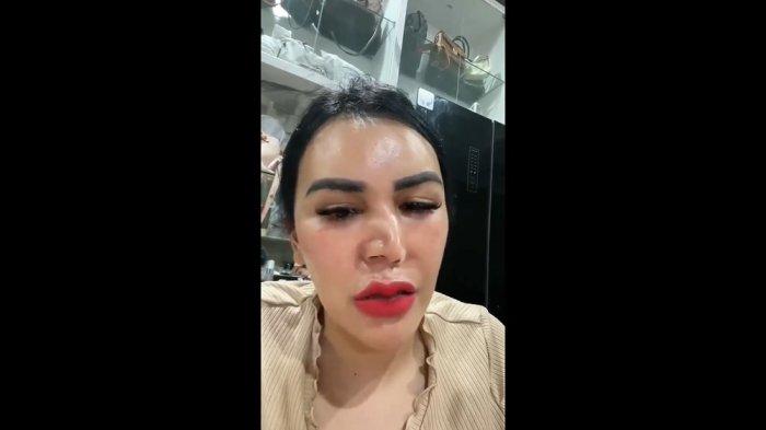 Hidung Ratu Talisha Alias Entok Bengkok Viral di Medsos: Dokter Ini Kek ...