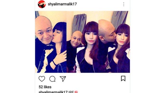 Pacar Barunya Berkepala Botak dan Politisi, Shyalimar Malik: Yang Botak ...