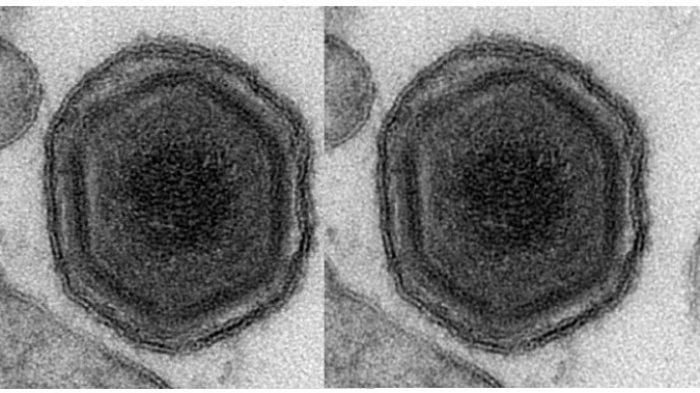 VIRUS Demam Babi Afrika Mengancam Indonesia? Ini 5 Fakta Ancamannya ...