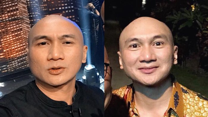 Anji Manji Bagikan Tips Tampil Percaya Diri meski Berkepala Botak ...