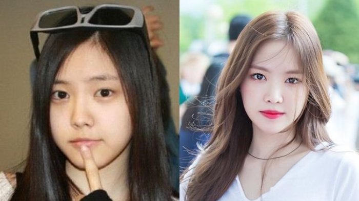 Naeun Without Makeup | Saubhaya Makeup